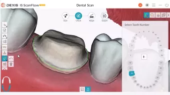 How-To Videos | DEXIS